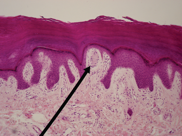 The Integumentary (Skin) System Tutorial | Sophia Learning