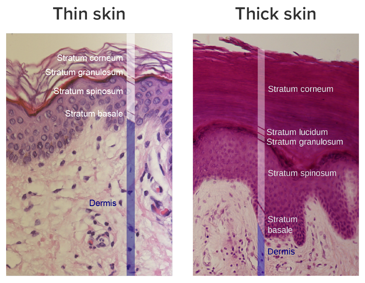Layers of the Skin Tutorial | Sophia Learning