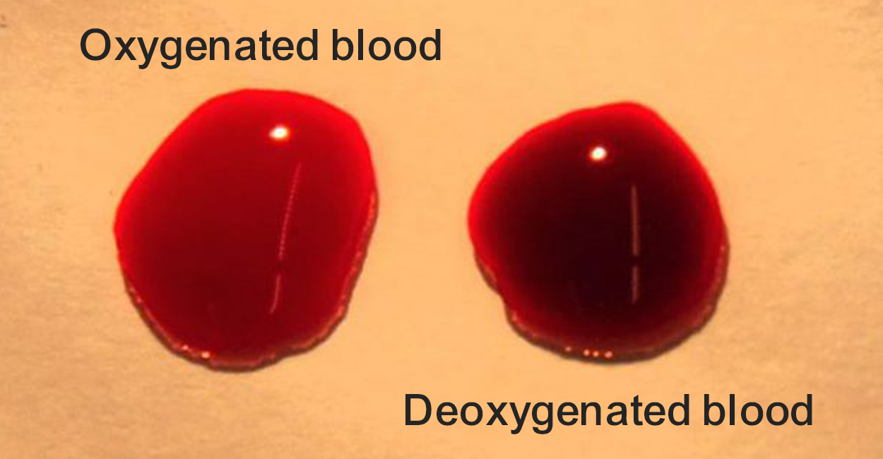 Pigmentation Tutorial | Sophia Learning