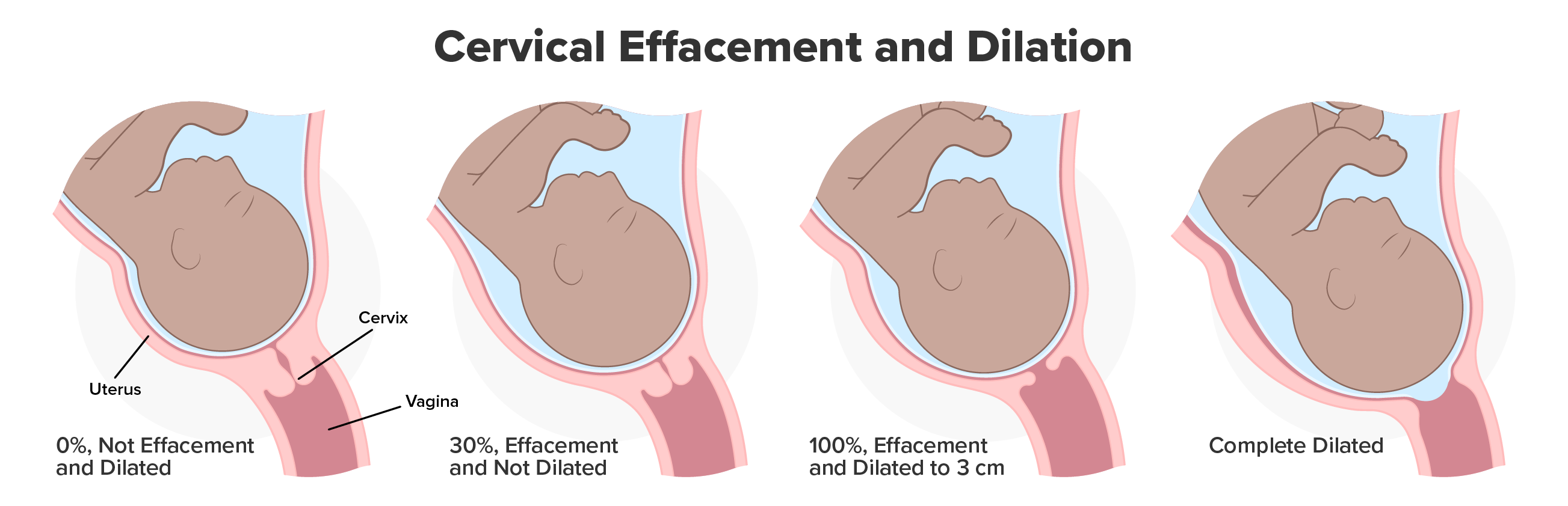 Labor and Birth Tutorial | Sophia Learning