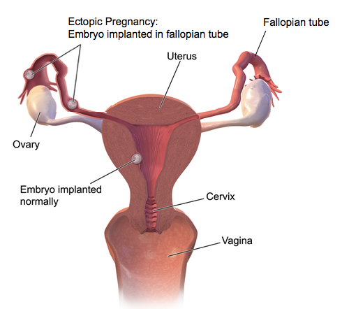 Implantation Tutorial | Sophia Learning